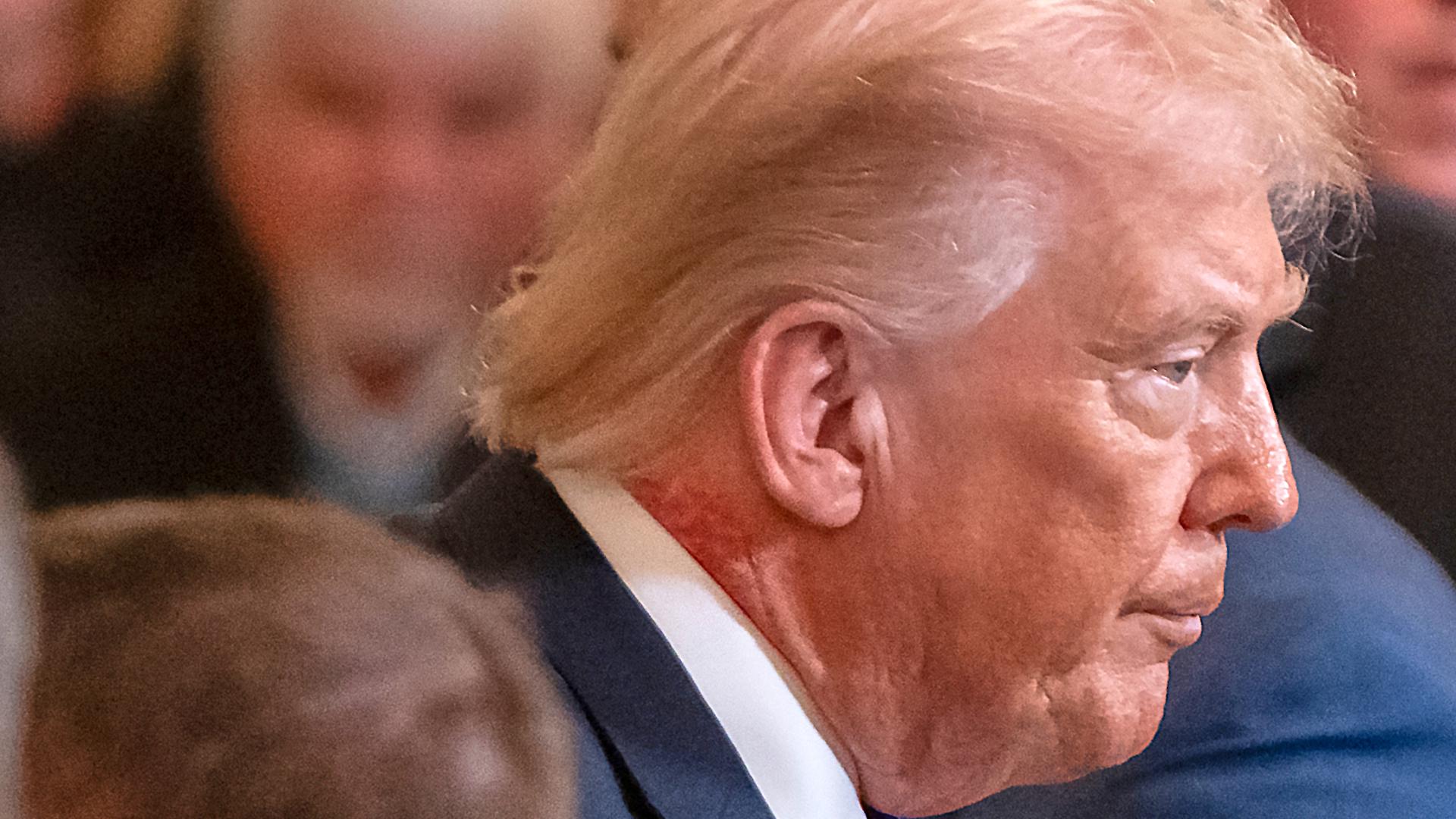 Trump's red neck caused by 'common skin cream,' White House says ...
