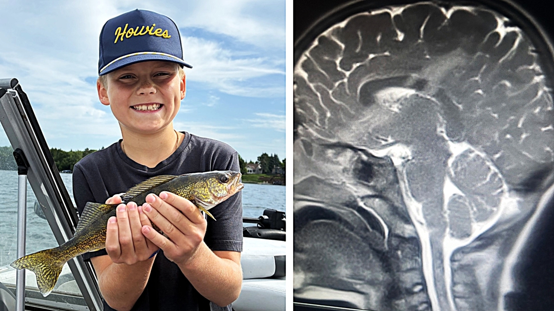 9-year-old MN boy survives arrow through his brain | king5.com