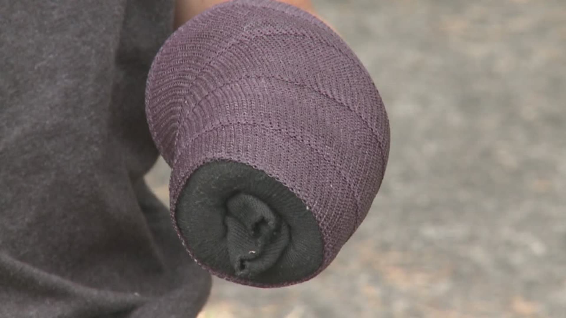 Lakewood teen who lost hand to firework shares warning (Graphic image ...