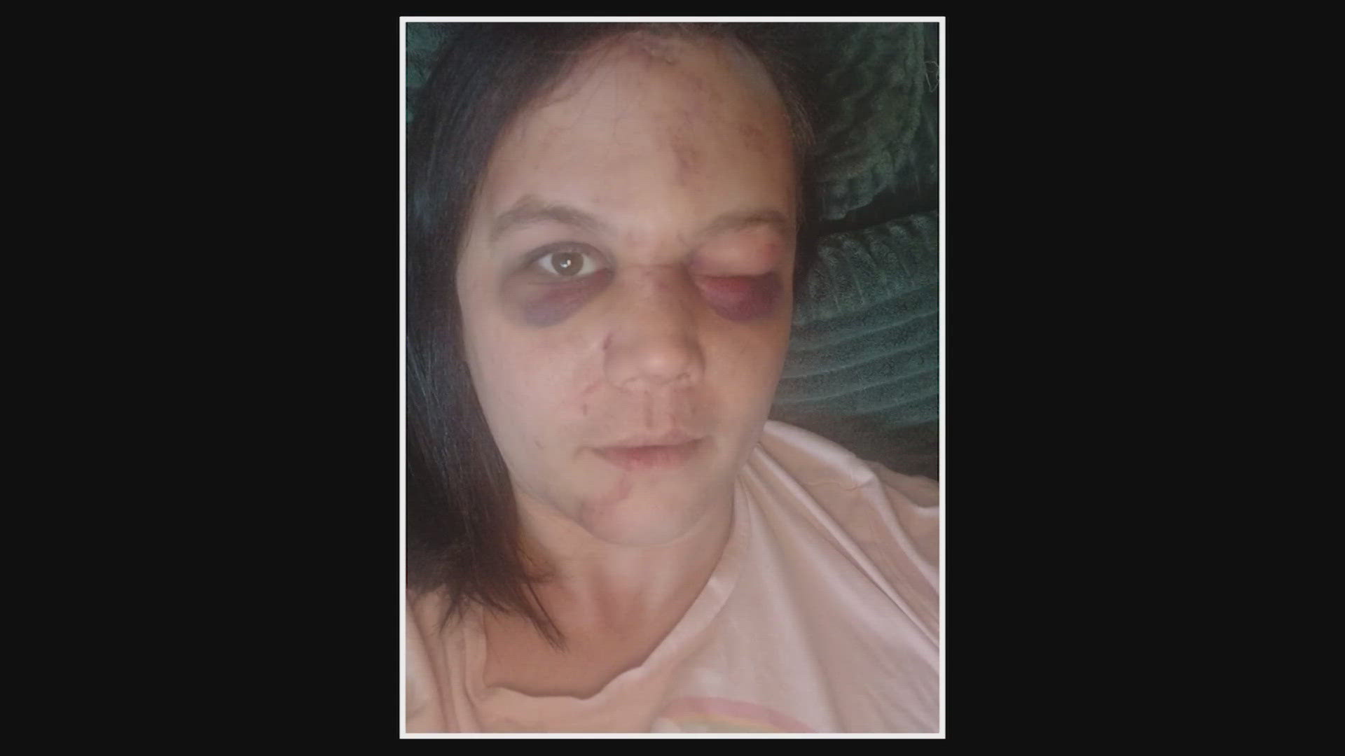 Outstanding suspects in Renton attack on transgender woman arrested ...