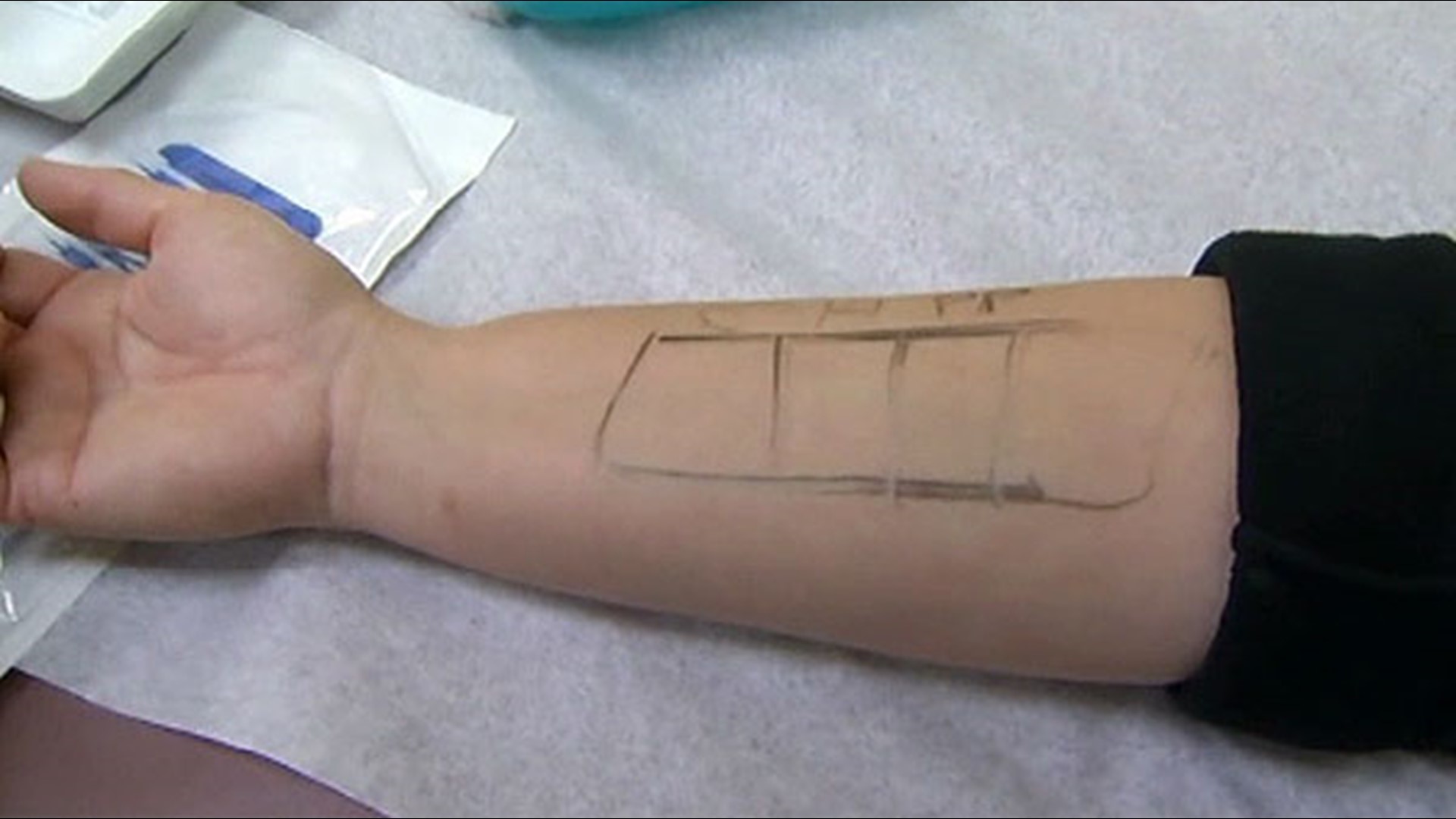 New test to determine if you're really allergic to penicillin | king5.com