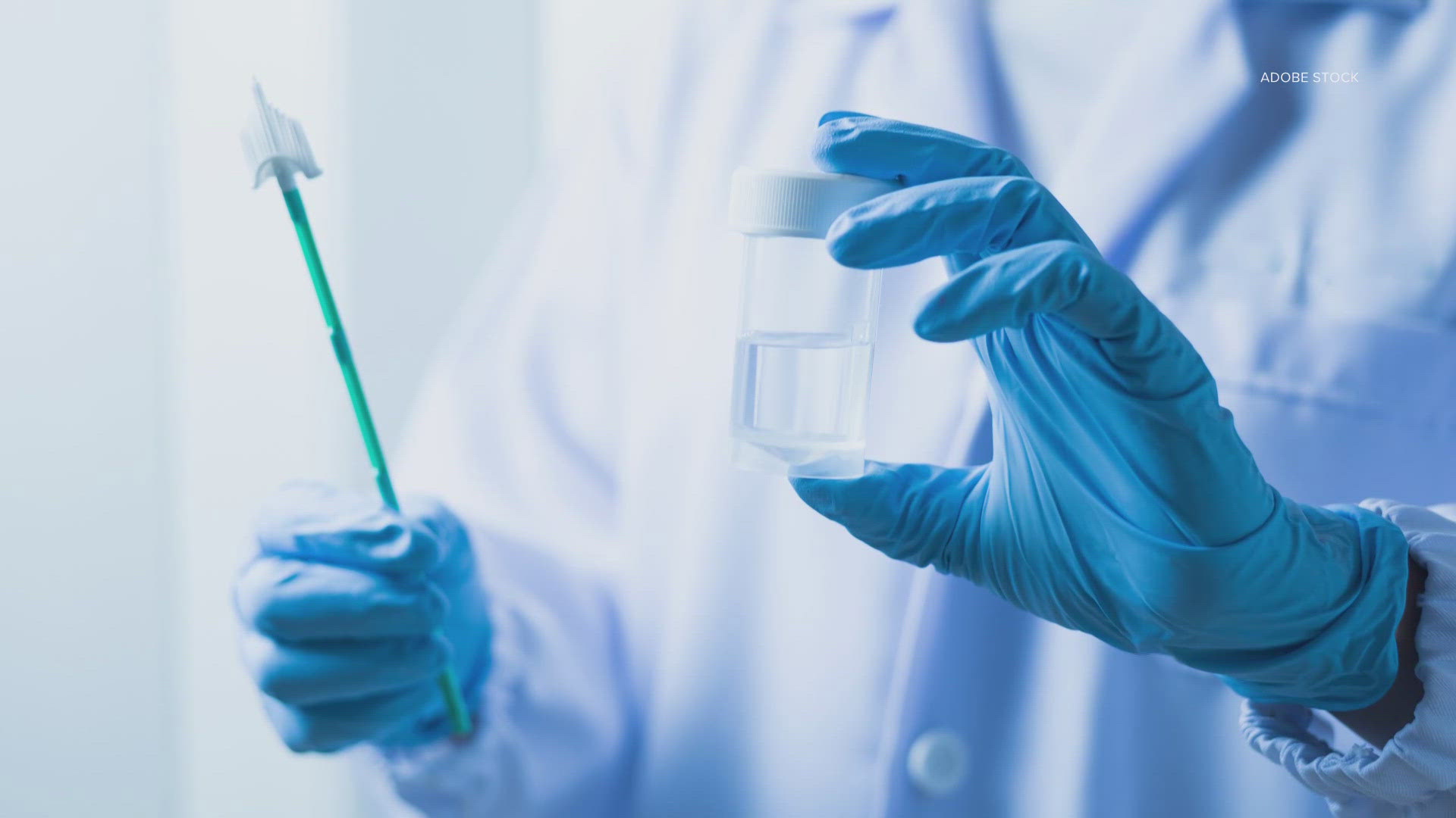 At-home HPV test now accepted in American Cancer Society's latest ...