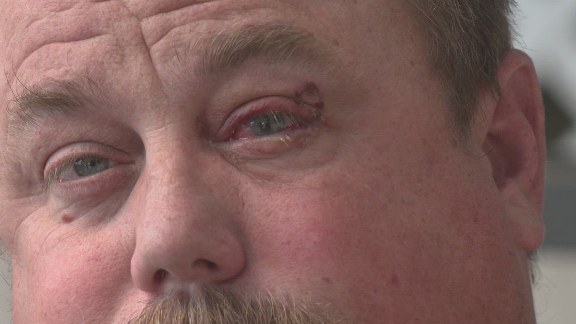 Truck driver shot in the eye with paintball gun | king5.com