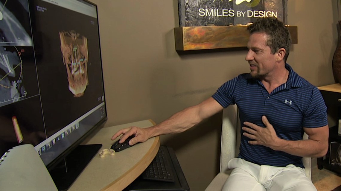 The unique procedure that can give you a new smile in one day | king5.com