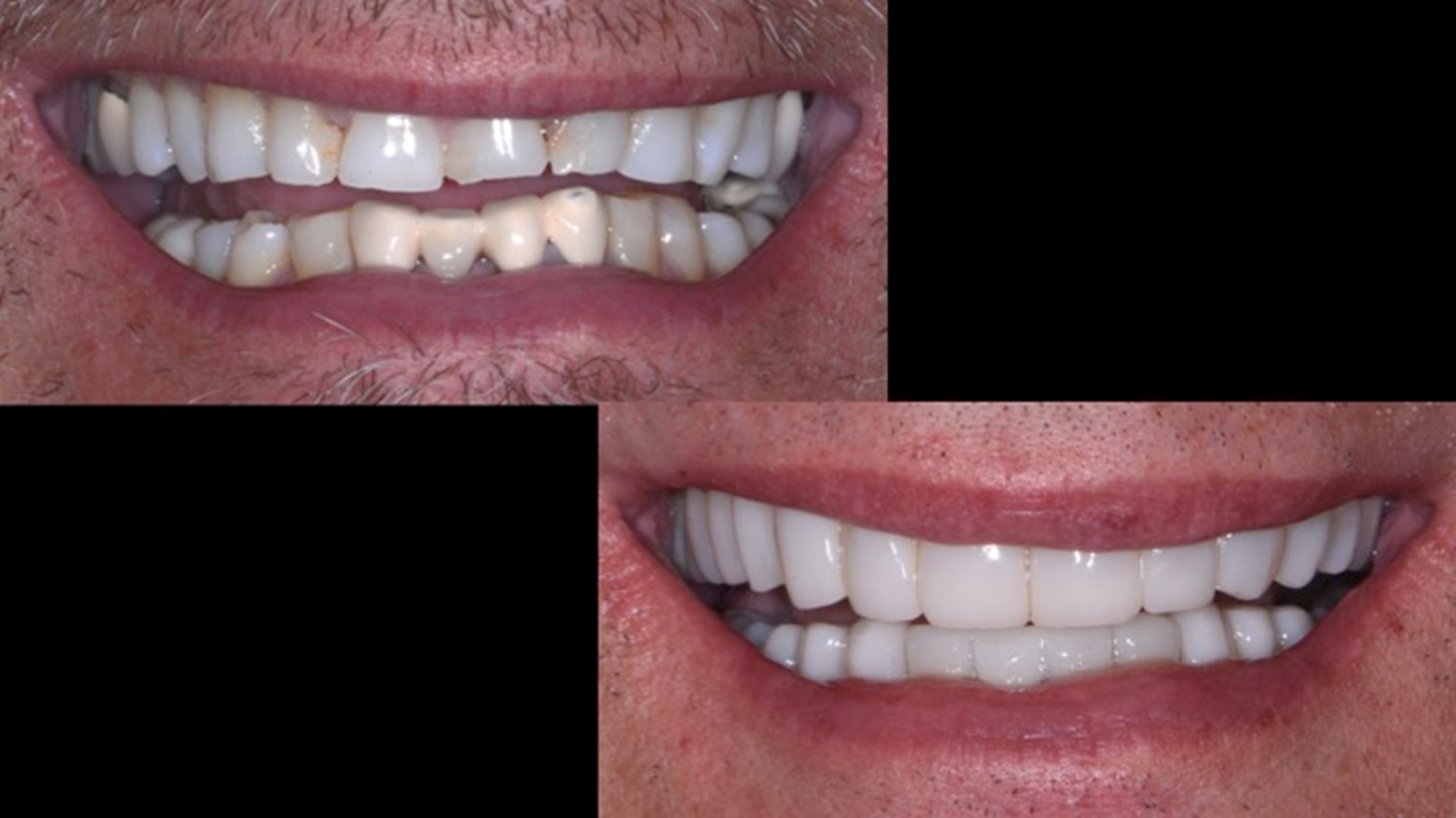 The innovative new Bioclear Method is non destructive to underlying ...