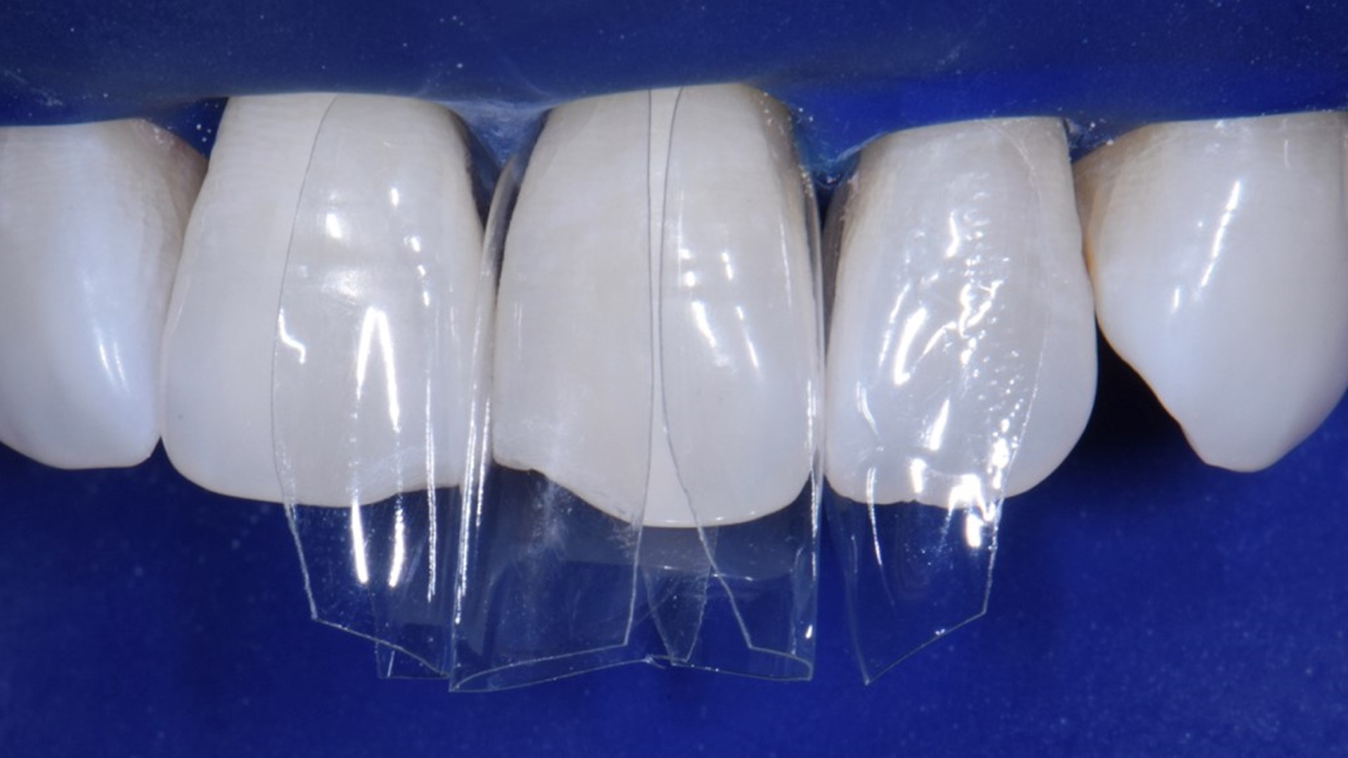 The innovative new Bioclear Method is non destructive to underlying ...