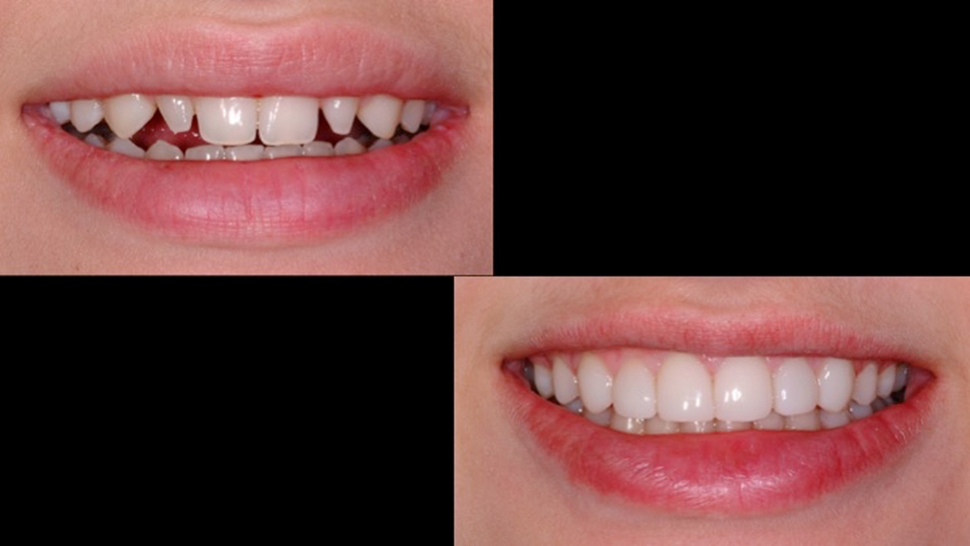 The innovative new Bioclear Method is non destructive to underlying ...