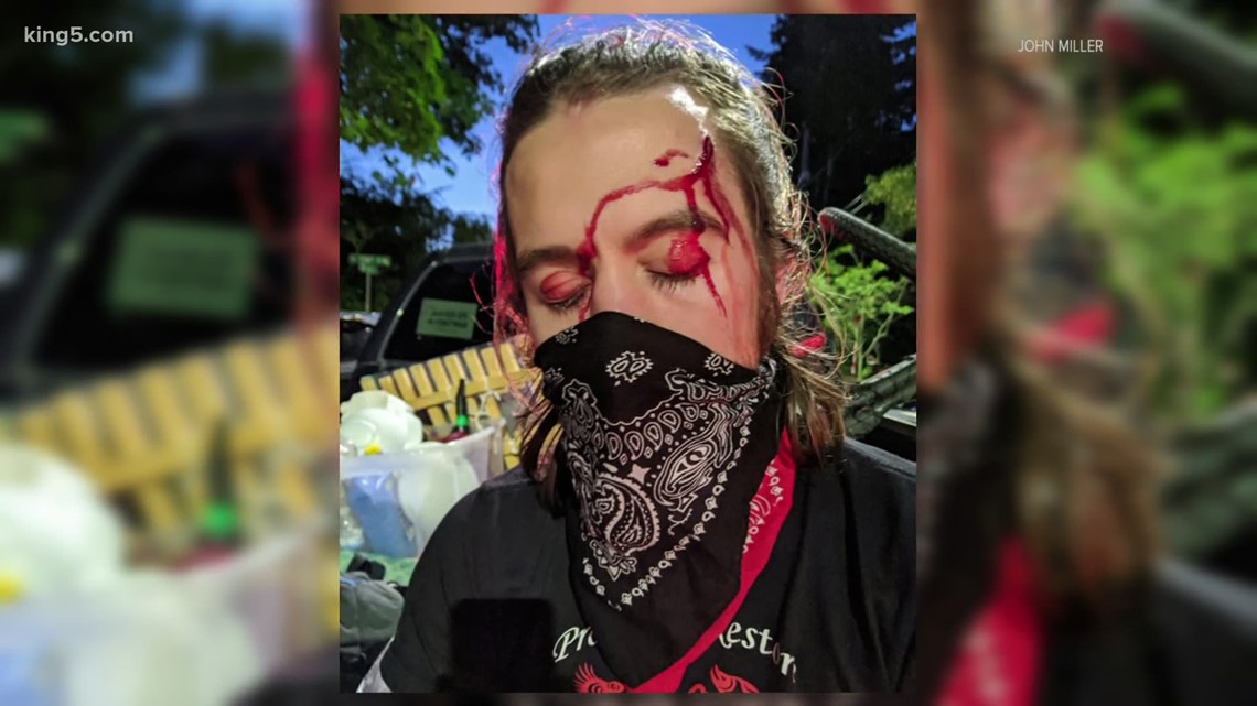 Seattle Bike Brigade member attacked during protest | king5.com