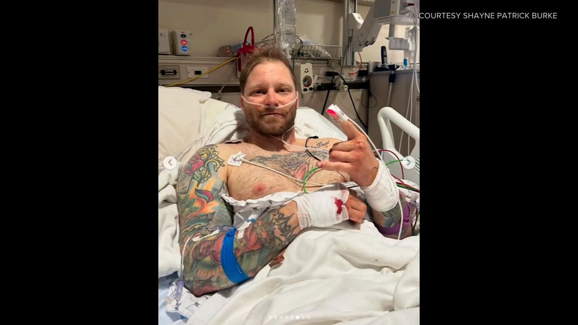 Man survives grizzly bear attack in Wyoming | king5.com