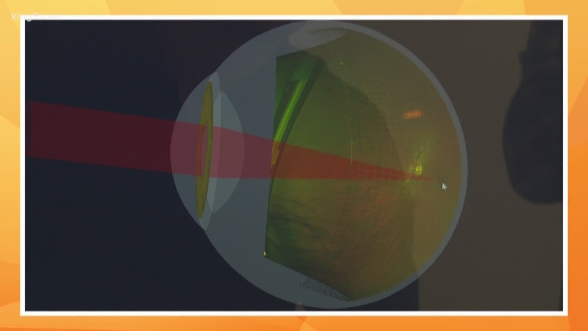 Not enough sunlight, too much screentime likely hurting kids' eyes ...