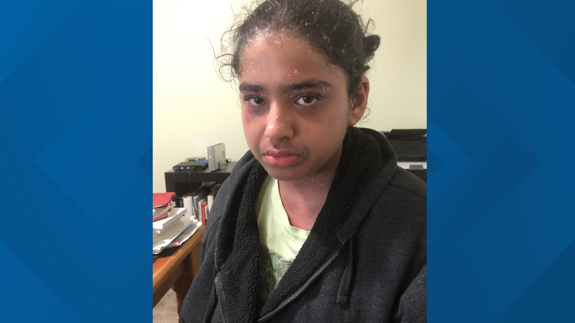 Bothell family sues Seattle hospital, alleges racist health care ...