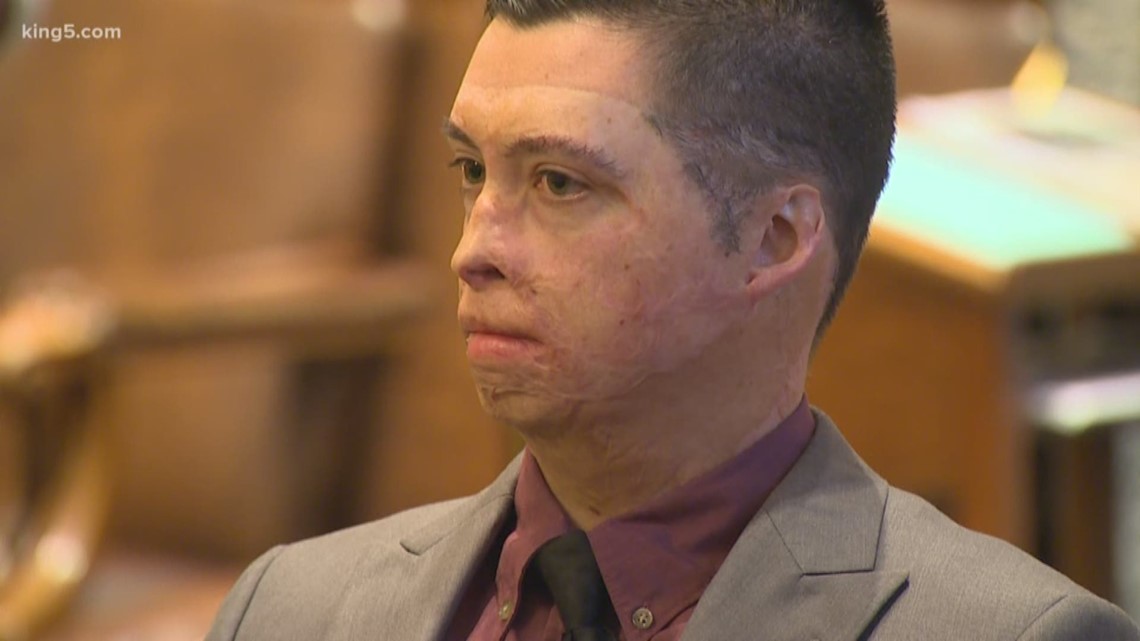 Severely-burned firefighter Daniel Lyon looks to make legal change in ...