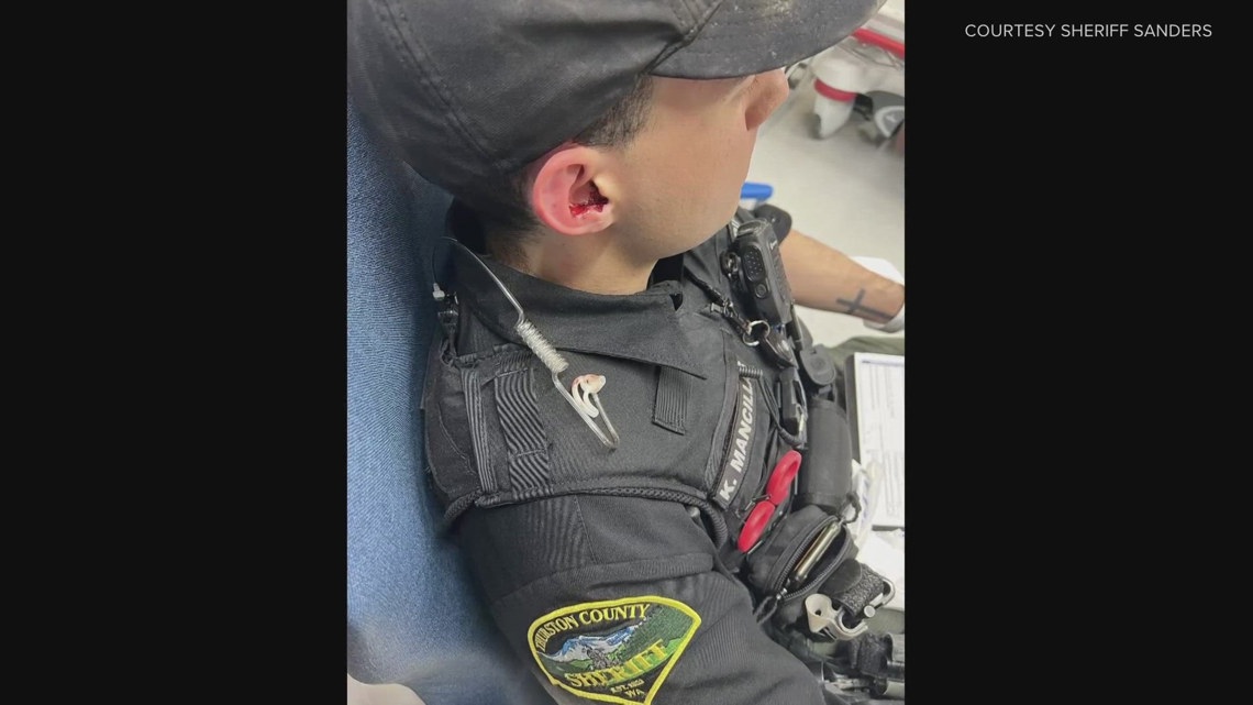 Deputy nearly has eye gouged out during fight with suspect, sheriff ...