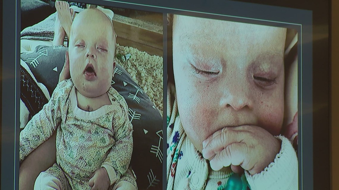 Trial of Seattle Children's hospital patients treated for mold exposure ...