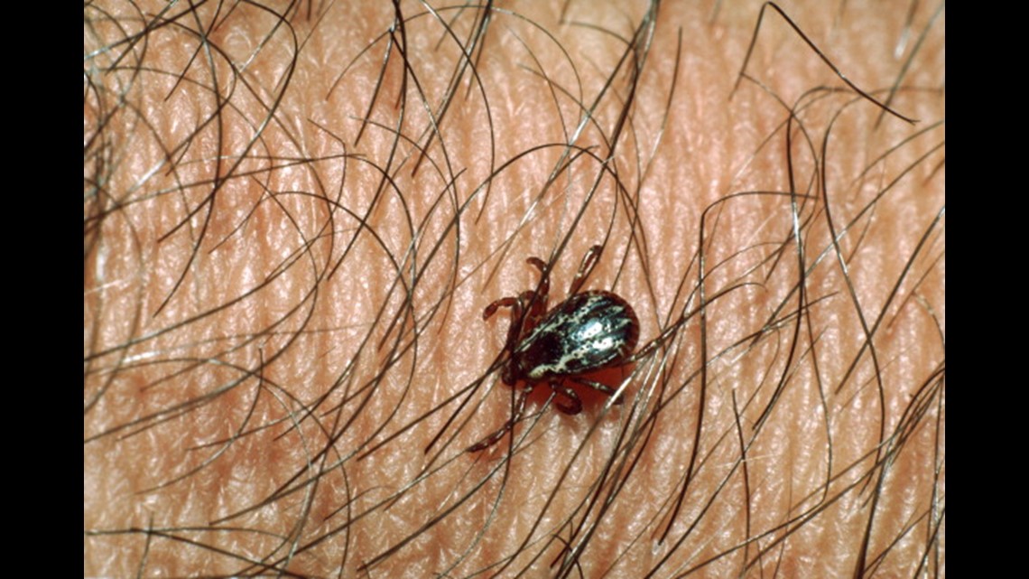 Should I burn a tick off? 5 common myths about ticks | king5.com