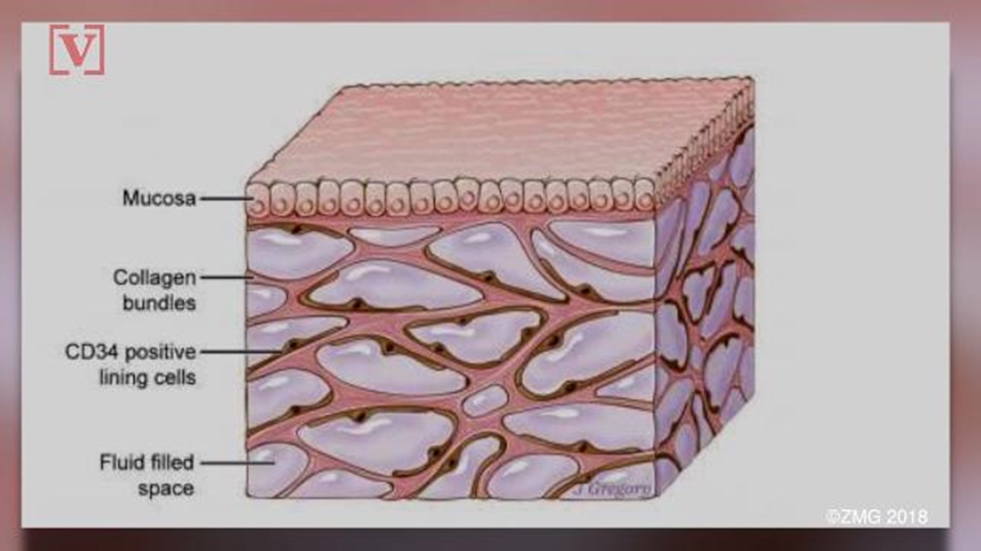 Scientists say they've discovered a new human organ: the interstitium ...