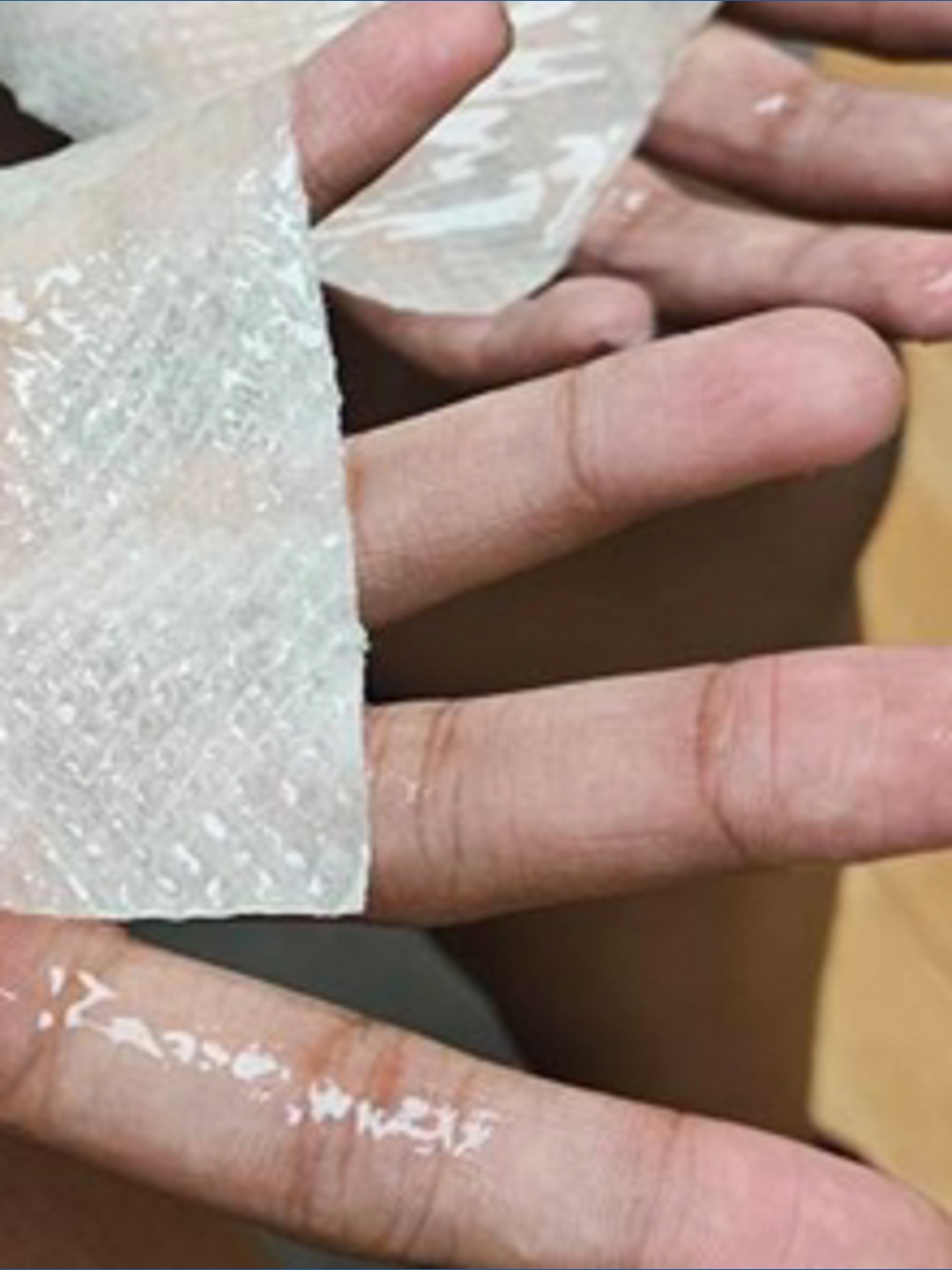 Indiana students get second-degree burns from punishment | king5.com